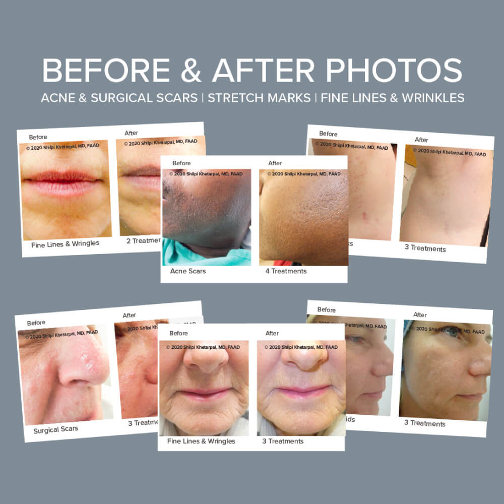 Before & After Photo Set One Time Purchase: Digital Download | REVIVE